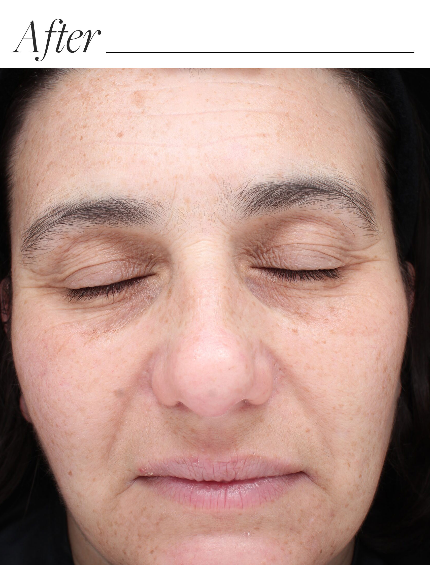 Ingenious Beauty: Meet “The Rolls Royce Of Collagen”