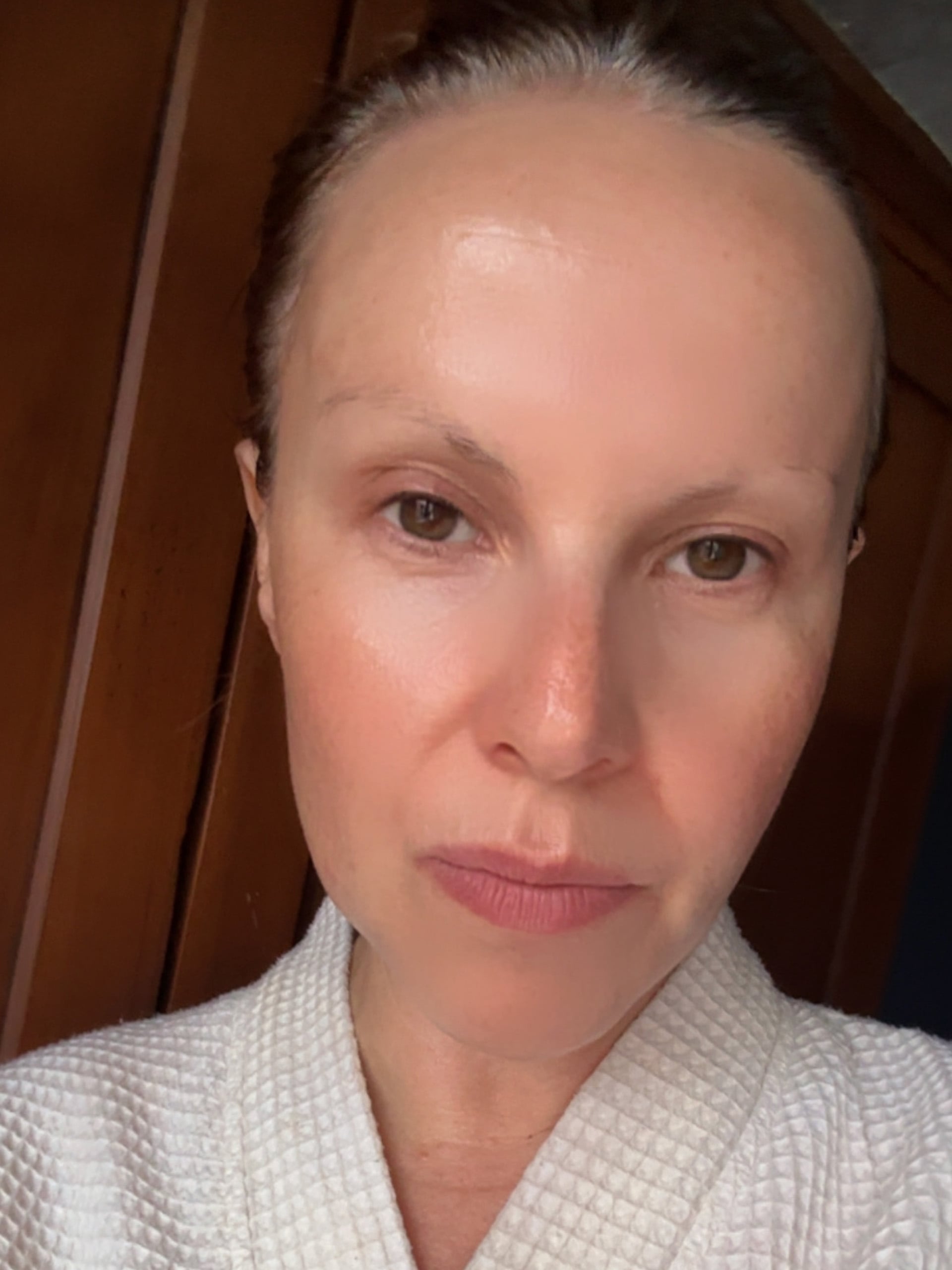 "I Tried Botox for The First Time - Here's How It Went" - The Handbook